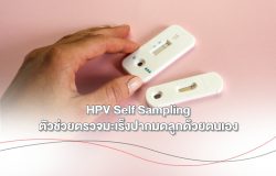HPV Self Sampling ตัวช่วยตรวจมะเร็งปากมดลูกด้วยตนเอง | Health and Trend
